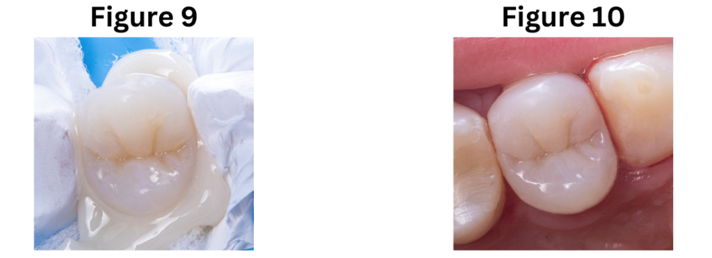Dr Patricio Guitierrez Case Study: Clinical Management of Deep ...